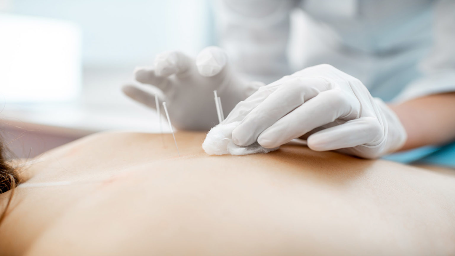 How Much Does Acupuncture Cost Pricing FAQs Of Acupuncture How Much Does Acupuncture Cost Pricing FAQs Of Acupuncture